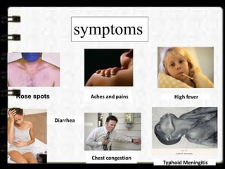 Typhoid | PPTX