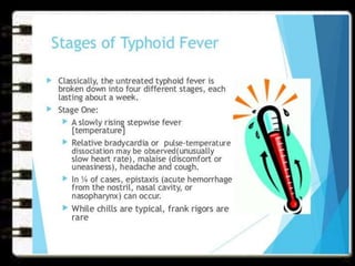 Typhoid | PPTX