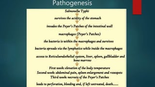 Typhoid fever case study, explanation and treatment | PPTX