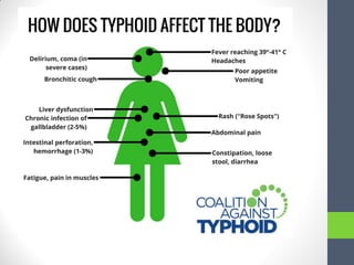 Typhoid... | PDF