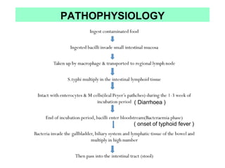 Typhoid | PDF