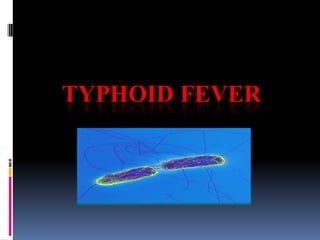 Typhoid | PPT