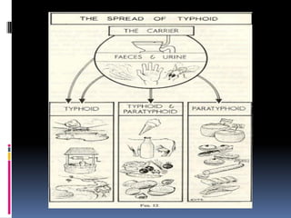 Typhoid | PPT