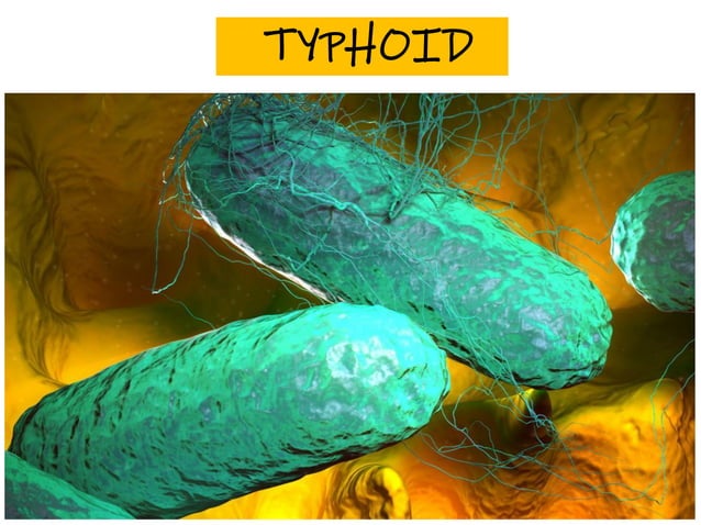 Typhoid | PPT