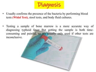 Typhoid | PPT