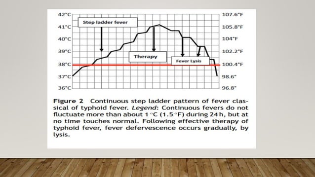 typhoid.pptx