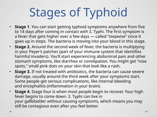 Typhoid fever.( Agent,Characteristics,Cause,Symptoms,Dignosis,Treatment ...