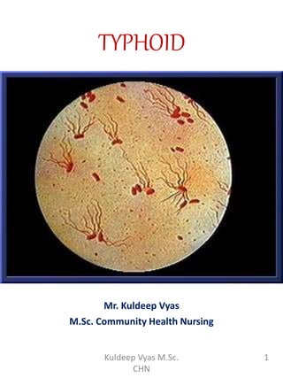 Typhoid Virus