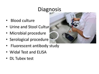 Typhoid control | PPT