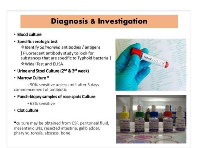 Typhoid control | PPT