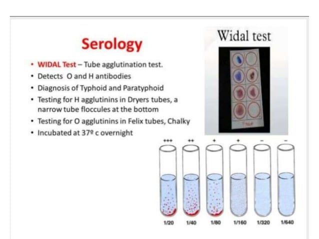 Typhoid control | PPT