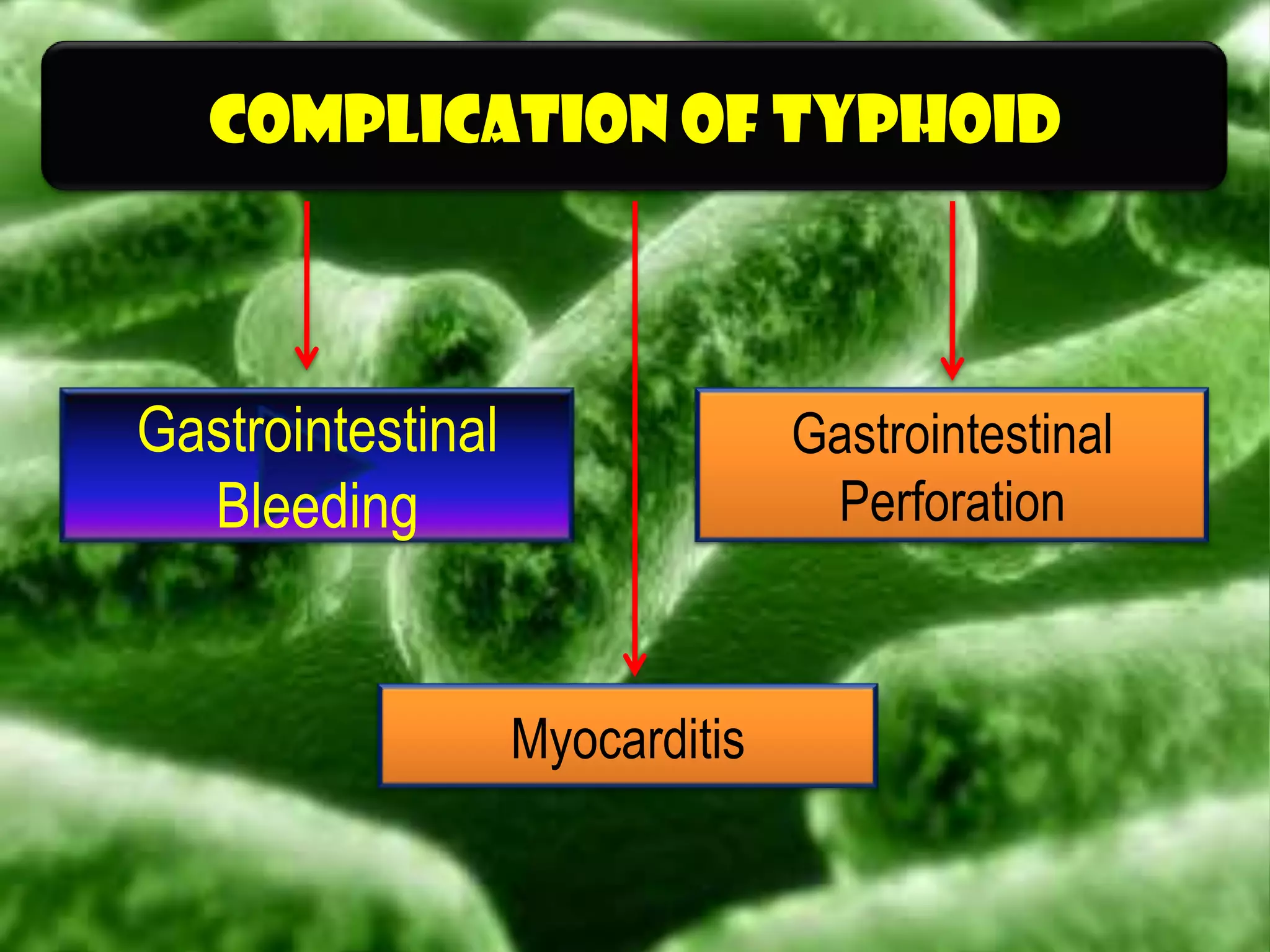 Typhoid disease | PPTX