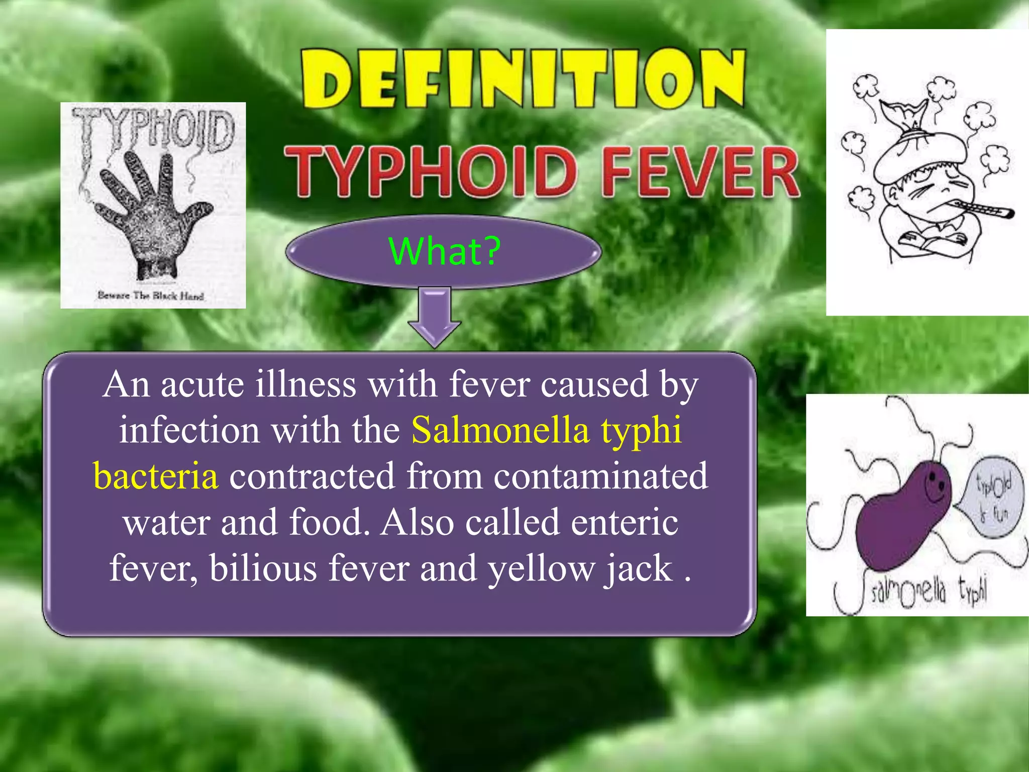 Typhoid disease | PPTX