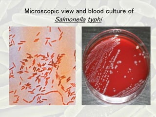 Typhoid fever 1 | PPTX | Infectious Diseases | Diseases and Conditions