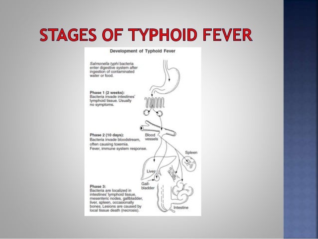 Typhoid fever