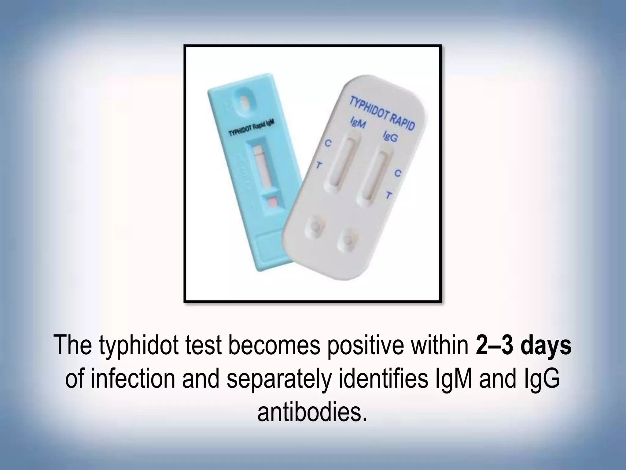 Typhoid fever | PPTX