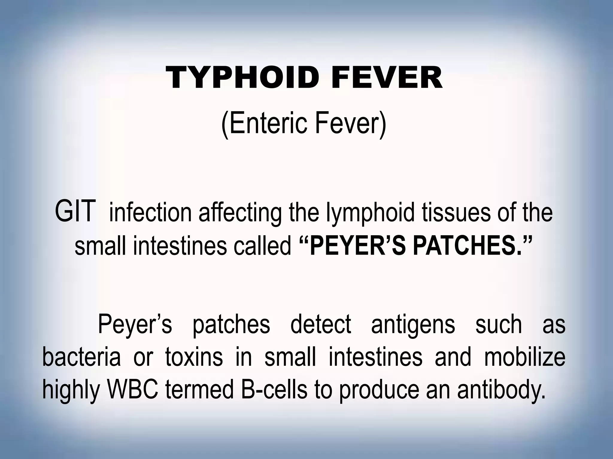 Typhoid fever | PPTX