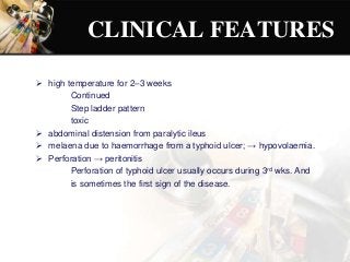Typhoid fever | PPTX