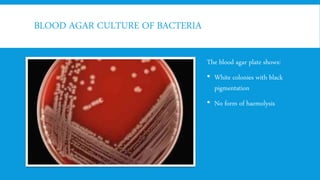 Typhoid fever | PPTX