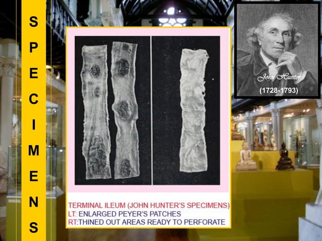 Typhoid fever | PPT | Free download