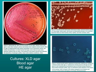 Typhoid fever (Enteric fever) | PPTX