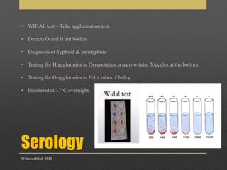 Typhoid fever | PPTX