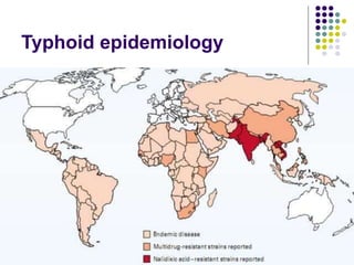 Typhoid fever.ppt