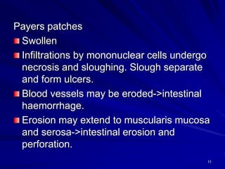 TYPHOID FEVER.& Other T. Diseases..pptx
