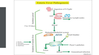 Typhoid fever overview | PPTX
