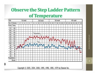 Typhoid fever deepa babin | PDF