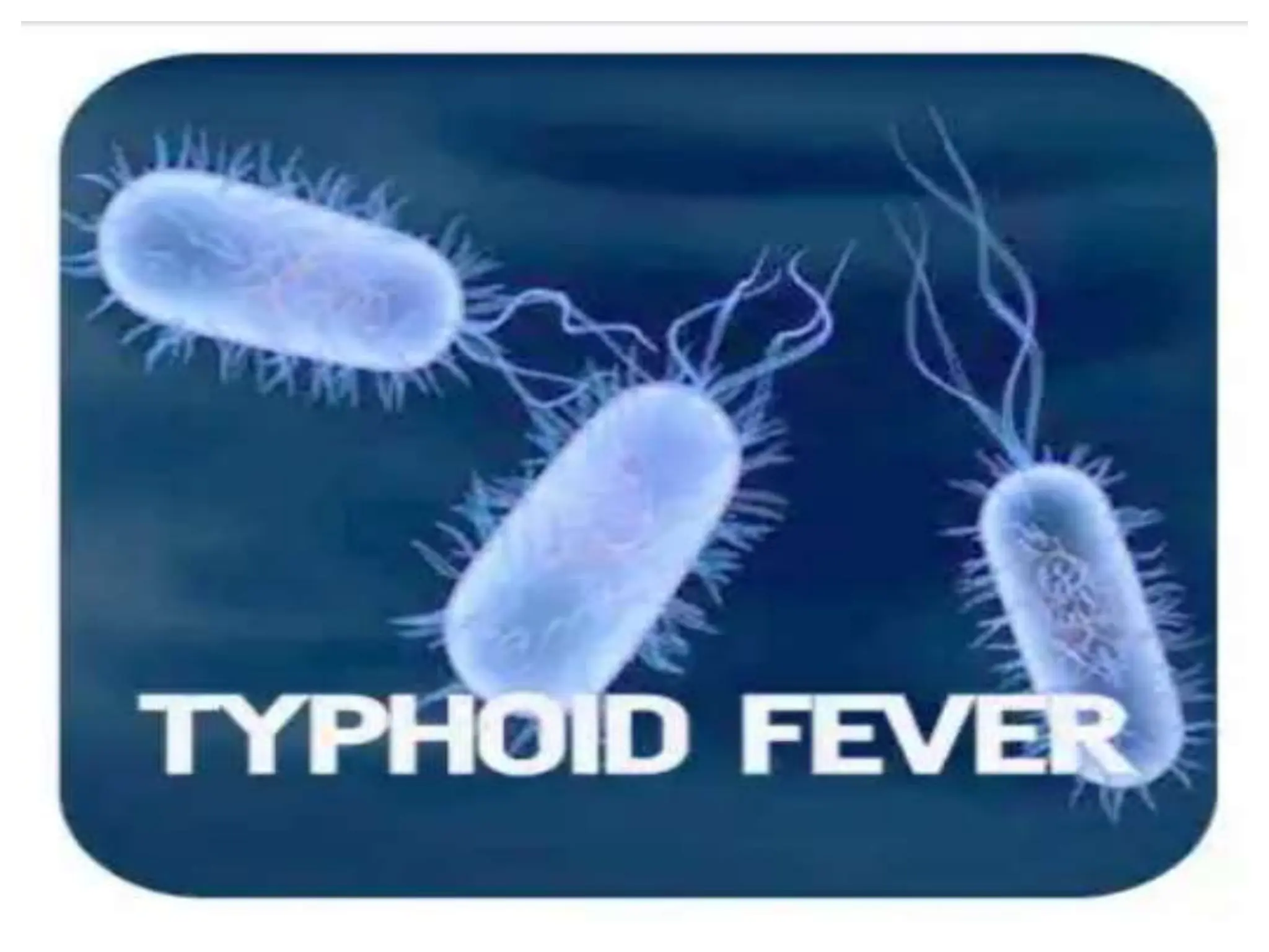 TYPHOID FEVER edited.pptx00000000000000 | PPTX