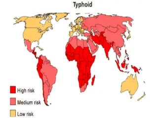 TYPHOID FEVER edited.pptx00000000000000 | PPTX