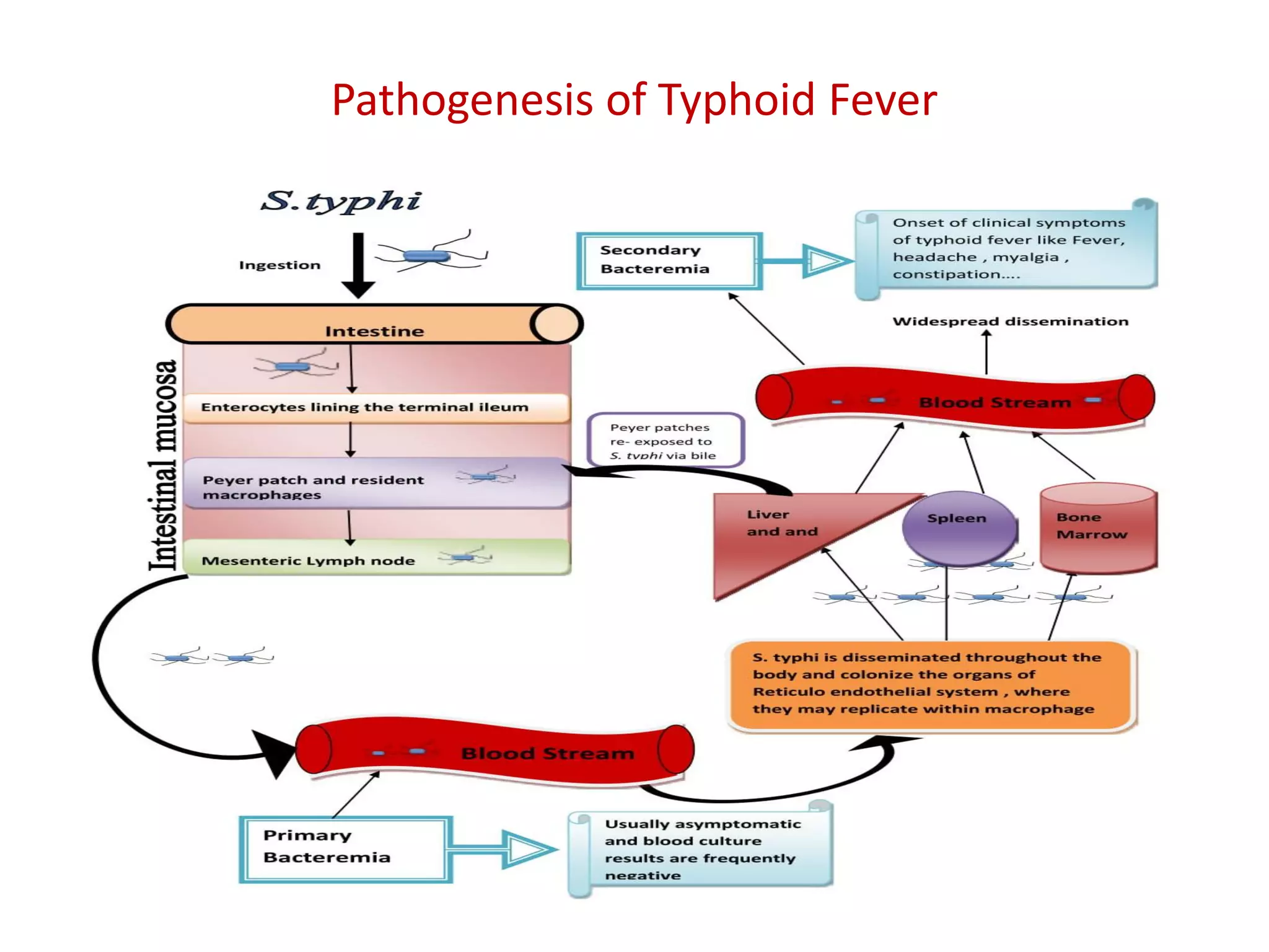 Typhoid fever in children 2021 | PDF