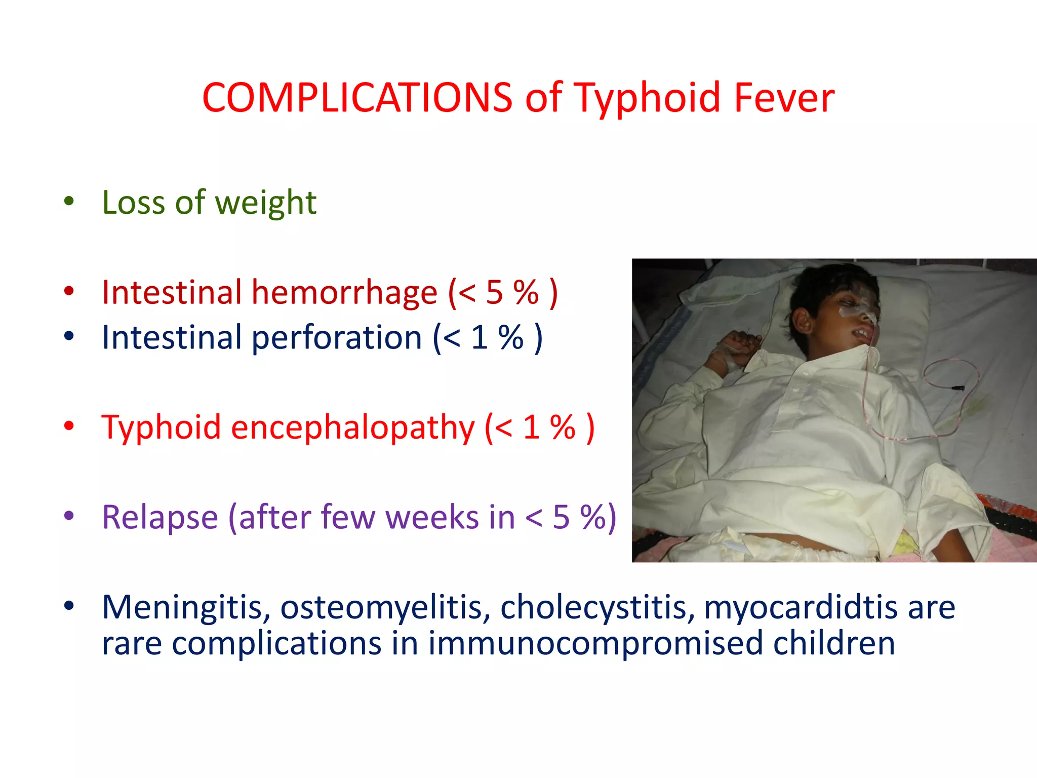 Typhoid fever in children 2021 | PDF
