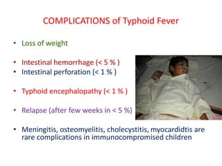 Typhoid fever in children 2021 | PDF