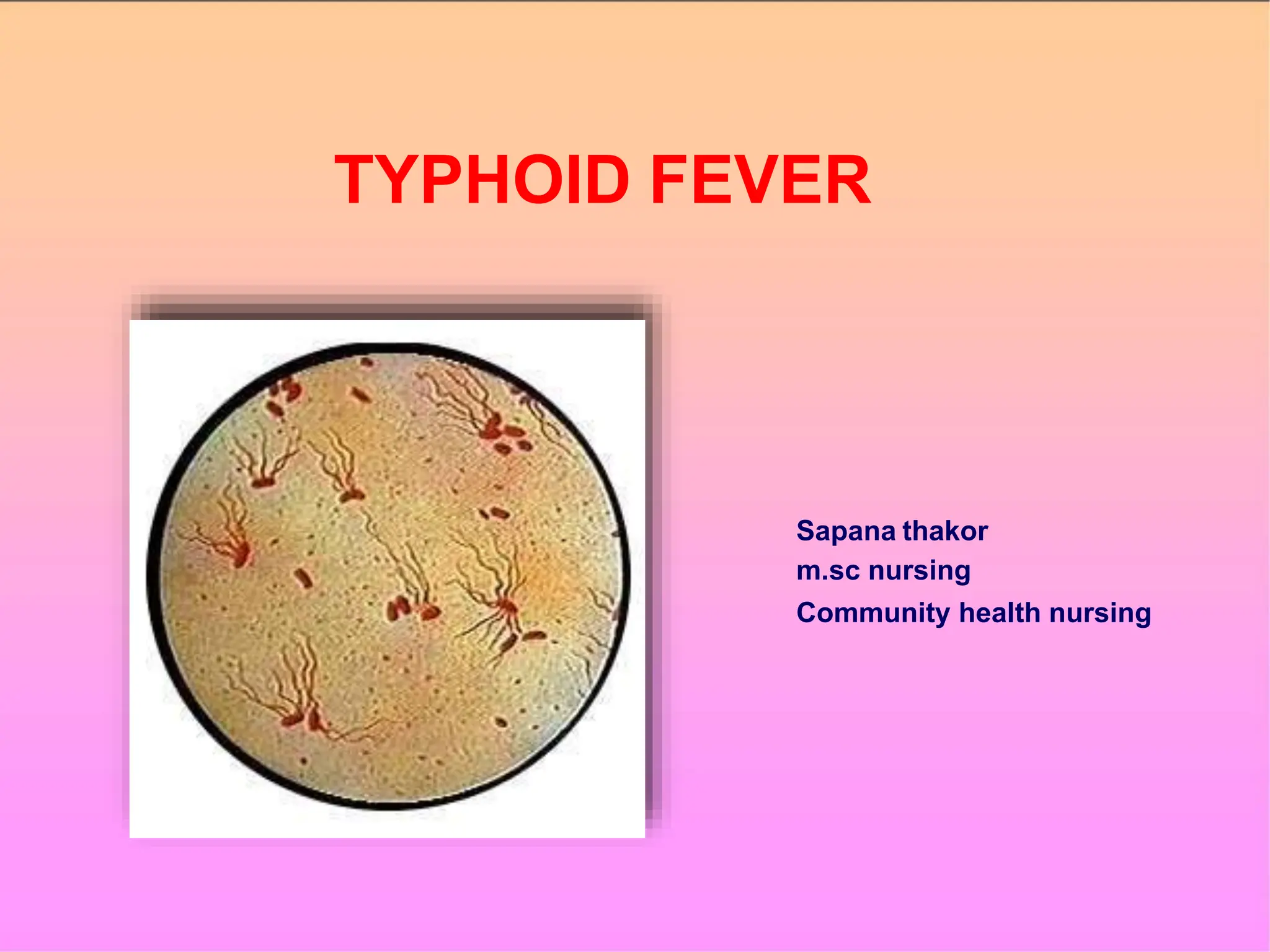 typhoidfeverppt-1812021.......24043.pptx