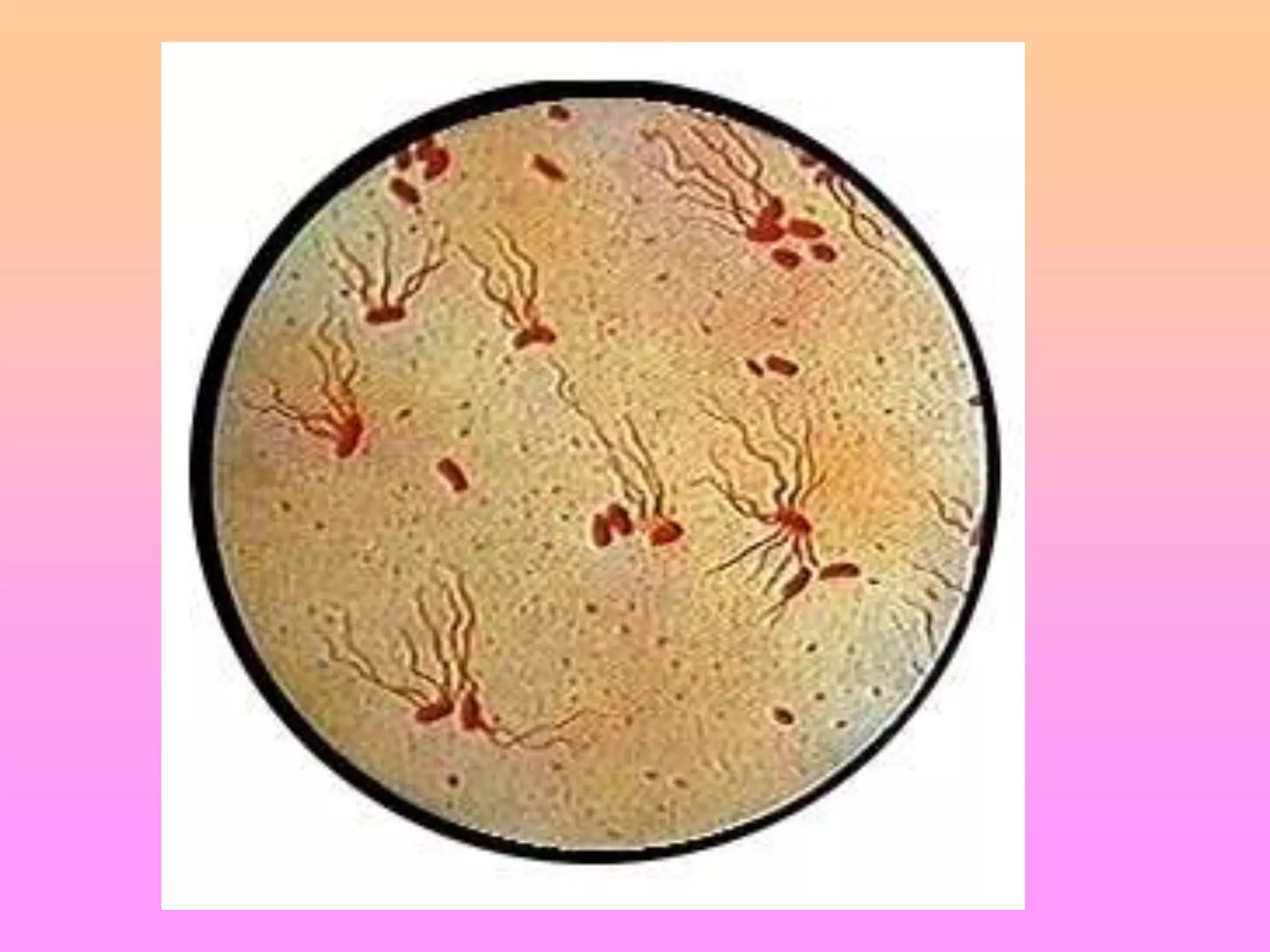 Typhoid fever ppt. | PPTX