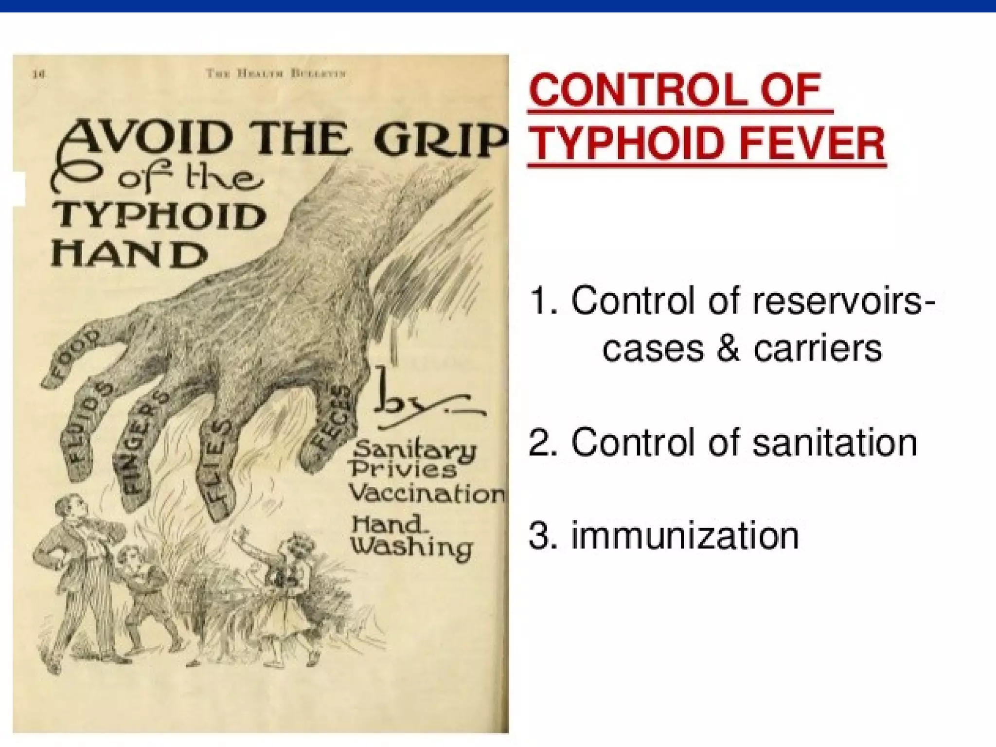 Typhoid fever ppt | PPT