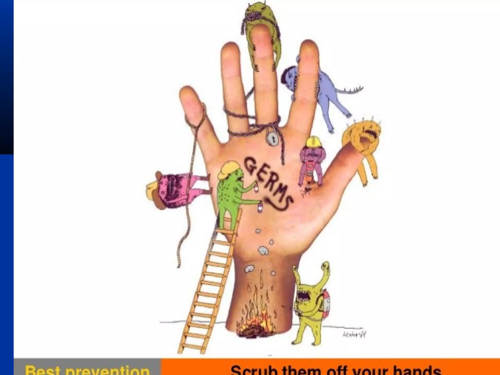 Typhoid fever ppt | PPT