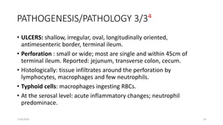Typhoid intestinal perforation | PPTX