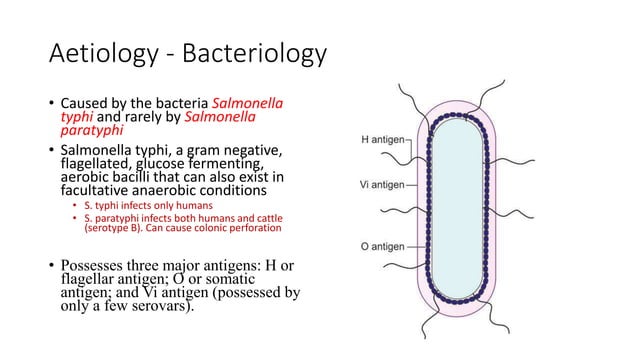 TYPHOID INTESTINAL PERFORATION | PPTX | Infectious Diseases | Diseases ...