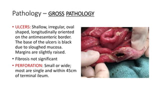 TYPHOID INTESTINAL PERFORATION | PPTX