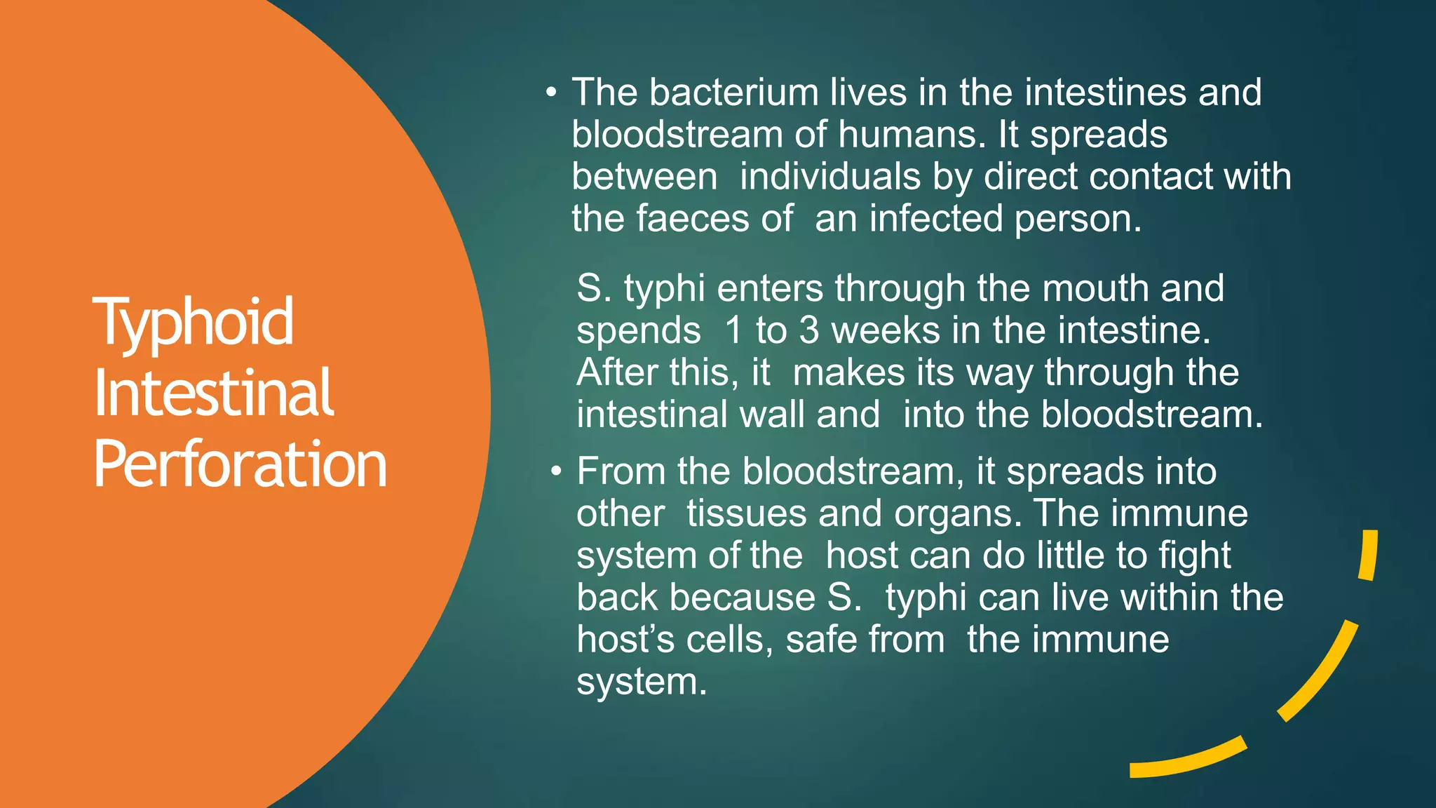 Typhoid Perforation | PPTX