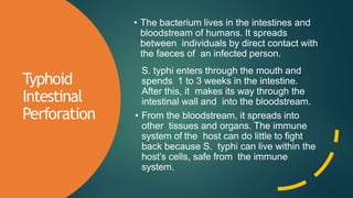 Typhoid Perforation | PPTX