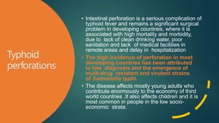 Typhoid Perforation | PPTX