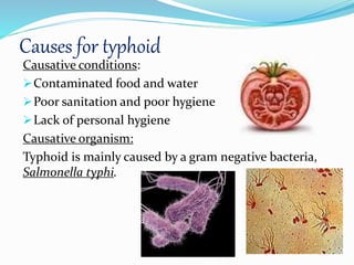 Typhoid ppt | PPTX