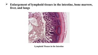 Typhoid ulcers, Enteric fever, all paramedical, B.Sc. Nursing ...