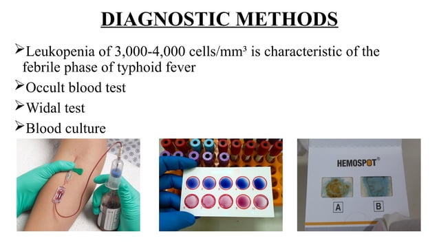 Typhoid ulcers, Enteric fever, all paramedical, B.Sc. Nursing ...