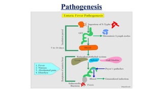 Typhoid ulcers, Enteric fever, all paramedical, B.Sc. Nursing ...