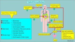 Typhoid ulcers, Enteric fever, all paramedical, B.Sc. Nursing ...